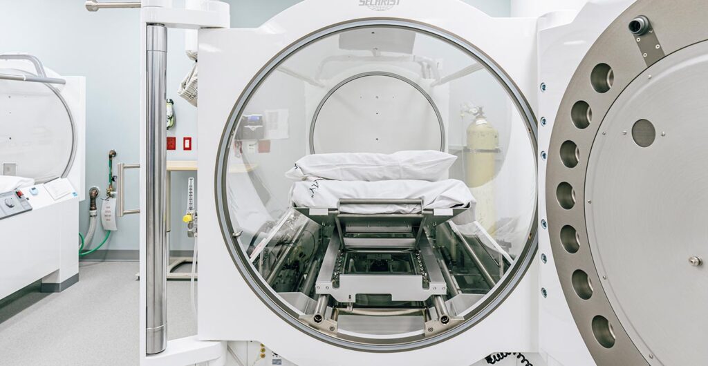 Top Hyperbaric Chambers in Los Angeles for Cutting-edge Therapy - Kiwi Box