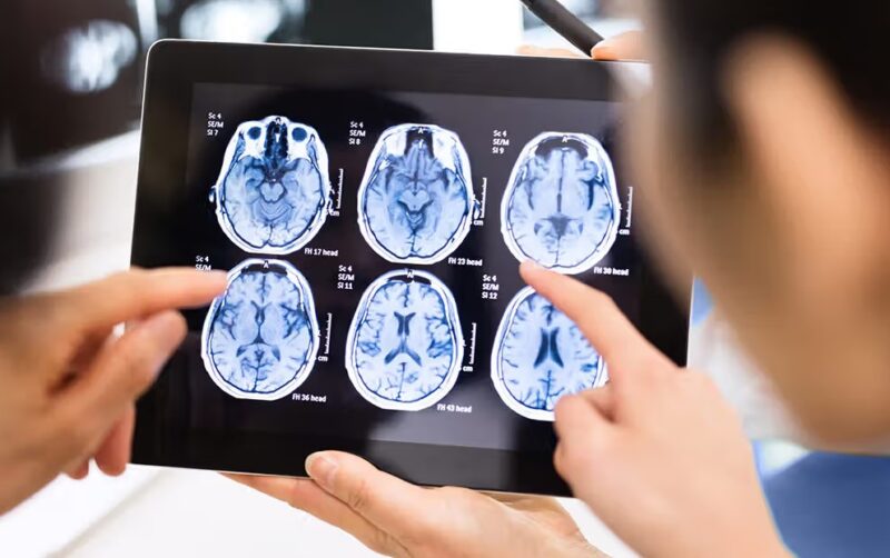 What’s the Difference Between EEG, MEG, and fMRI? - KiwiBox